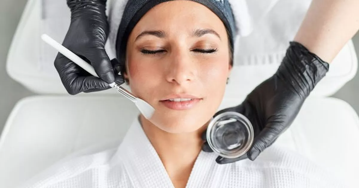 How to perform a safe and effective peel?