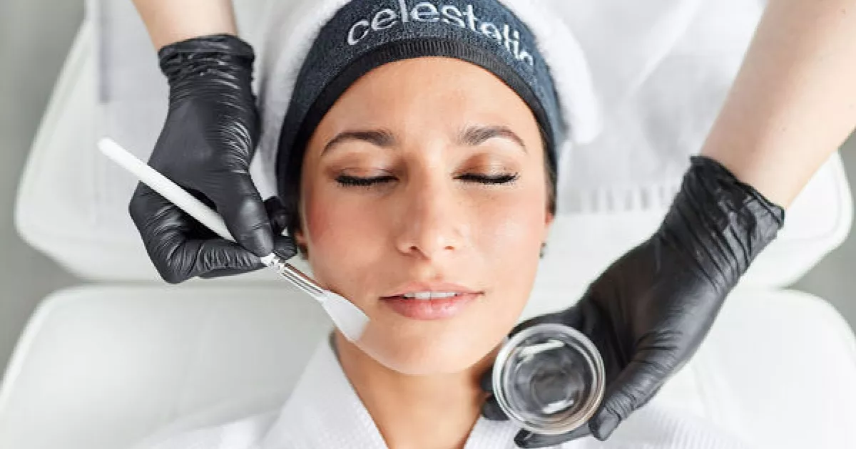 Hoe voer je een veilige en effectieve peeling uit?